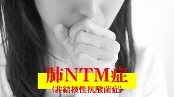 【危険】3カ月以上長引くせき「肺NTM症」が増加傾向 日常に潜む菌で感染…死亡者数は結核の1.5倍 中高年・女性・痩せ型の人は特に注意｜FNNプライムオンライン