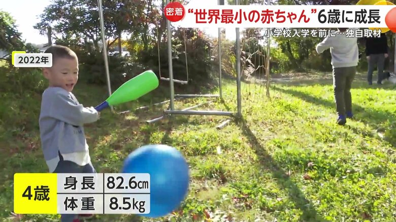 258gで生まれた“世界最小の赤ちゃん”が6歳に…夢は警察官 母は「元気で楽しそうで幸せ」来年は小学生 「言葉」の成長も｜FNNプライムオンライン