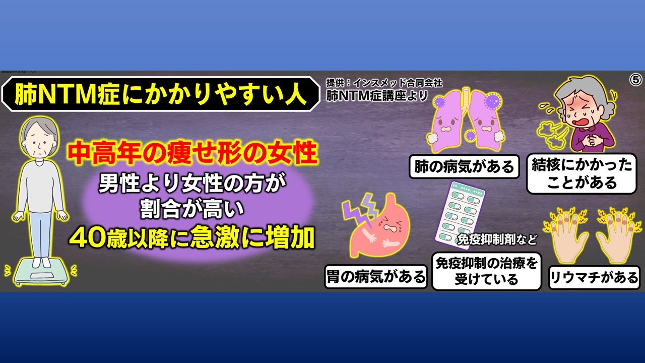 【危険】3カ月以上長引くせき「肺NTM症」が増加傾向 日常に潜む菌で感染…死亡者数は結核の1.5倍 中高年・女性・痩せ型の人は特に注意｜FNNプライムオンライン