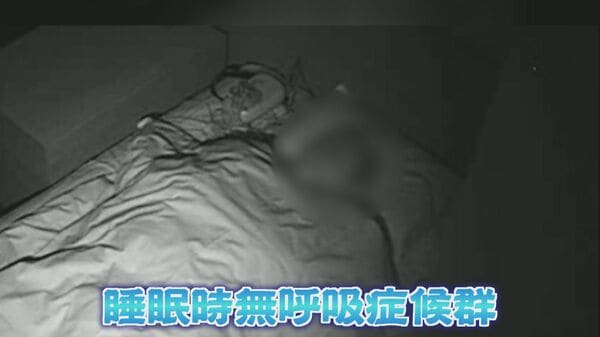 あなたは大丈夫？ 睡眠時「無呼吸」のリスク 肥満の人がかかるイメージだが… 痩せ体型でも危険 【福岡発】｜FNNプライムオンライン