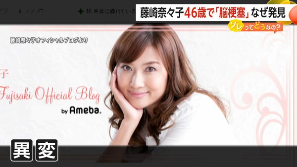 藤崎奈々子46歳で「脳梗塞」公表…「めまい以外症状なし」 若い年齢で発症することも…脳梗塞かもしれない“10のチェックリスト”｜FNNプライムオンライン