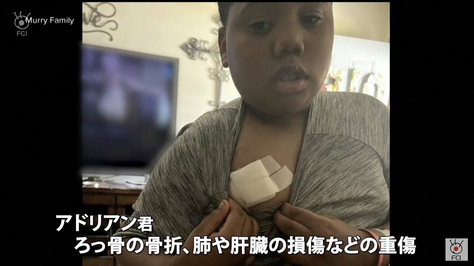 助けを求めて通報した11歳少年に警察官が発砲 米・ミシシッピ州｜FNNプライムオンライン