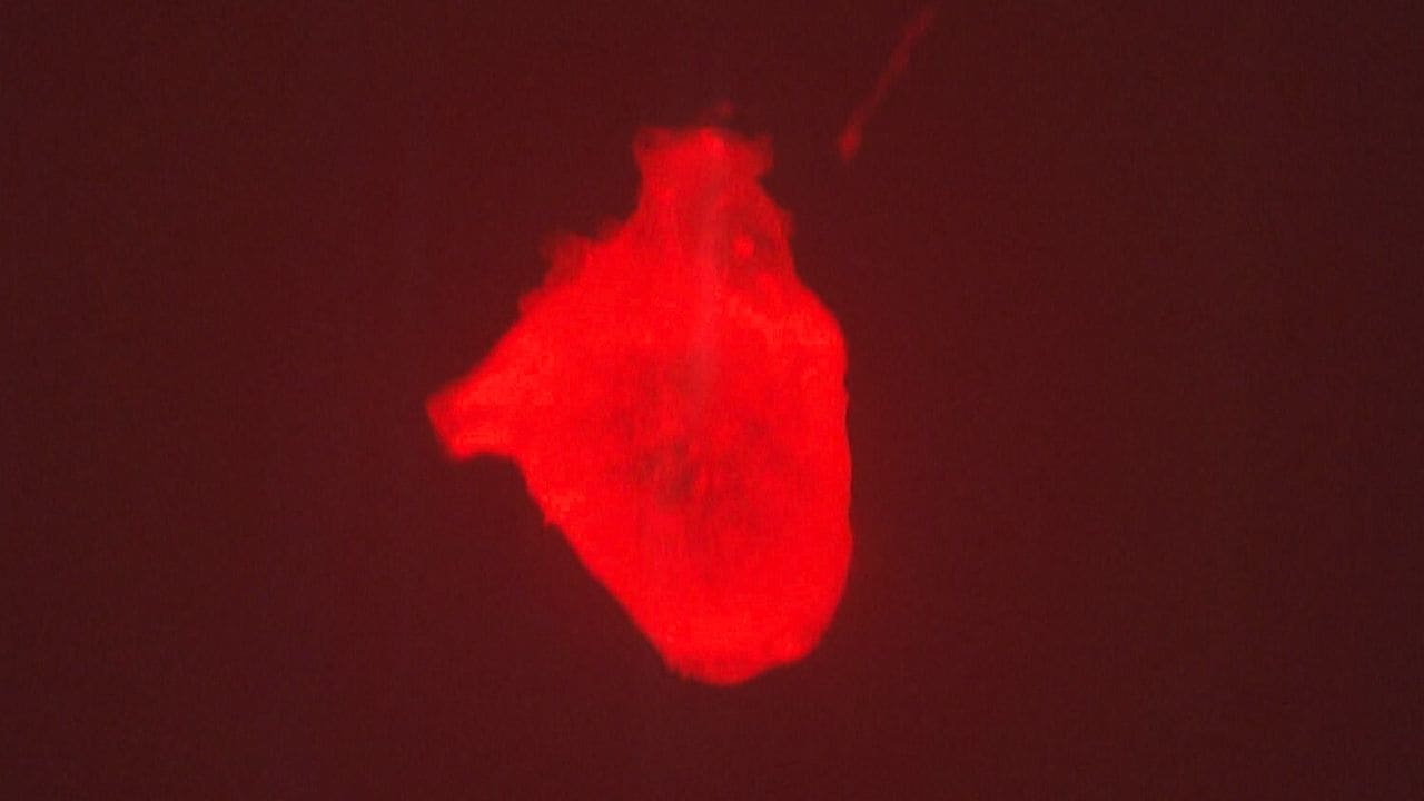 「心臓病では誰も死なせない」万博の目玉『iPS心臓』に挑む医師と科学者 少年の運命を変えた従兄の死｜FNNプライムオンライン