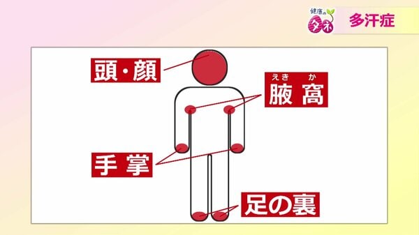 体質と諦めないで！手汗や脇汗で日常生活に支障…それは「原発性局所多汗症」かも 適切な診断と治療でQOL向上を｜FNNプライムオンライン